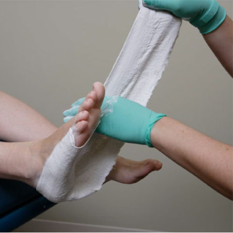 Casting - Infinity Orthotics